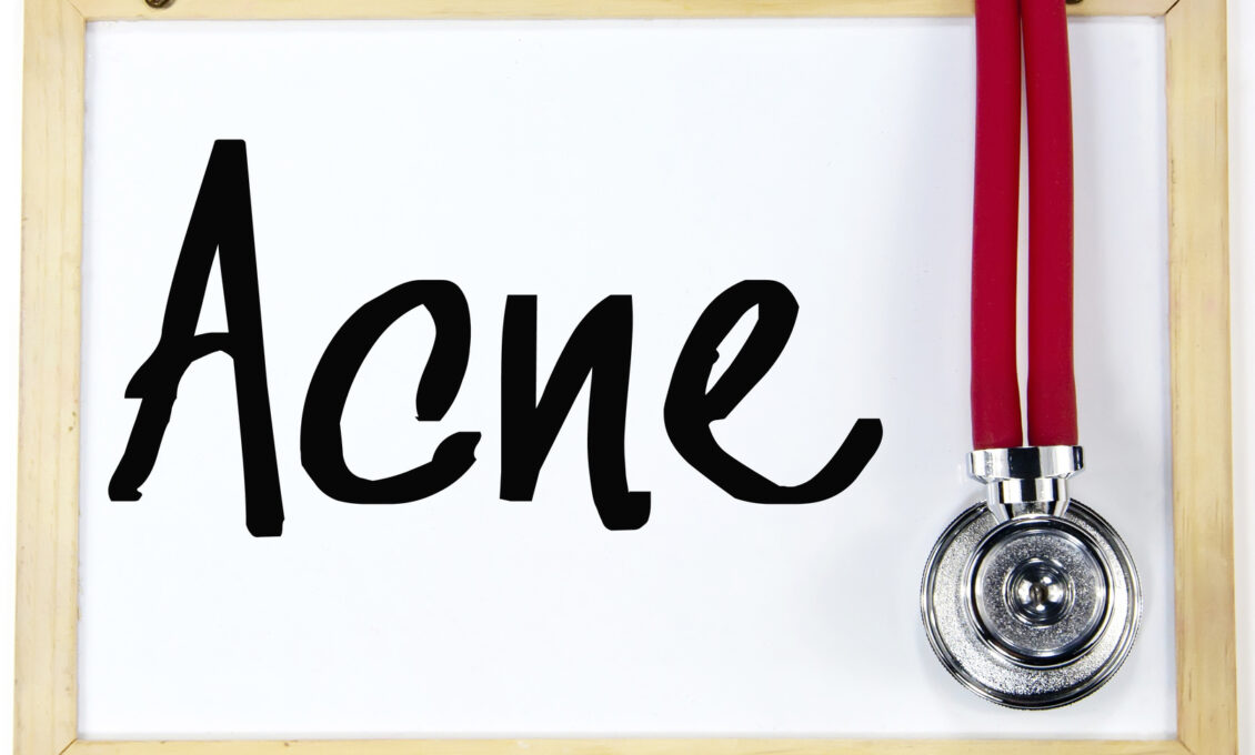 Understanding Acne Scars & Post-Inflammatory Hyperpigmentation | ABQ ...